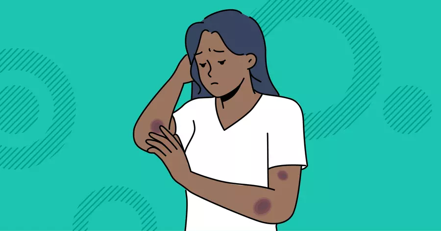 4 Chronic Lymphocytic Leukemia Skin Symptoms | MyLeukemiaTeam