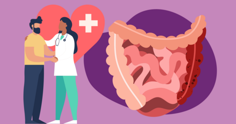 J-Pouch for Ulcerative Colitis: 8 Things To Know | MyCrohnsAndColitisTeam