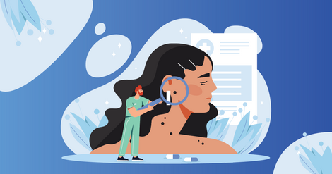 9 Types of Melanoma Skin Cancer: Photos and Symptoms | MyMelanomaTeam