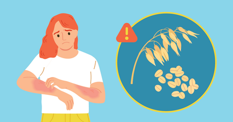 7 Facts About Sugar Allergy | MyFoodAllergyTeam