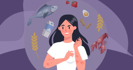 Can Food Intolerance Cause Weight Gain? | MyFoodAllergyTeam