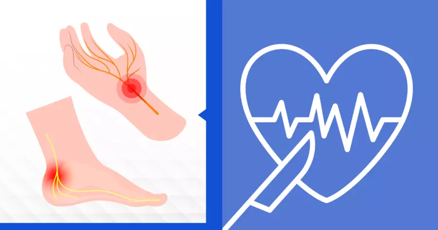 Neuropathy After Heart Surgery: Causes and Treatments for Nerve Damage ...