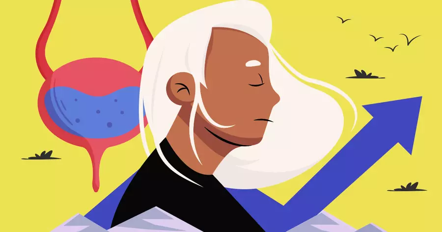 Bladder Cancer Survival Rates: By Age, With Treatment, and More ...