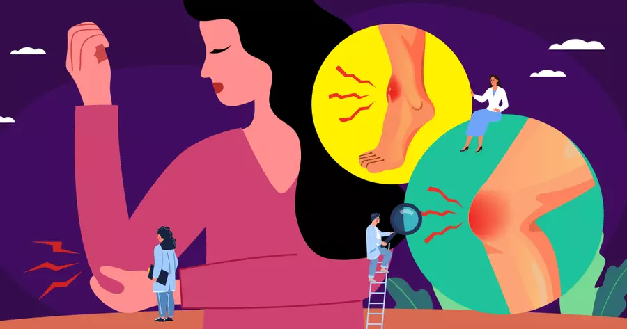 4 Ways Chronic GVHD Can Affect the Joints: Swelling, Pain, Range of ...