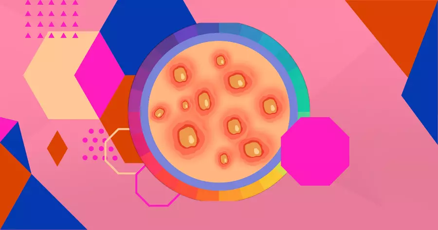 What Color Pus Is Bad? What To Know About Wounds (VIDEO) | myHSteam