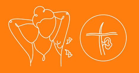 Difference Between a Hidradenitis Suppurativa vs Pilonidal Cyst | myHSteam