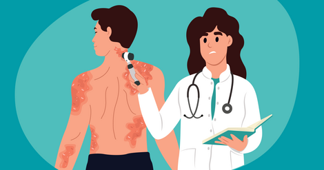 What Does a GVHD Rash Look Like? Photos and Symptoms | myGVHDteam