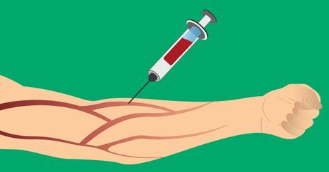 7 Facts About the Thymus Gland and Myasthenia Gravis | MGteam