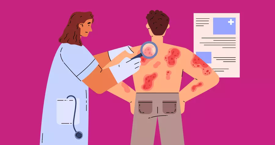 What Does a GVHD Rash Look Like? Photos and Symptoms | myGVHDteam