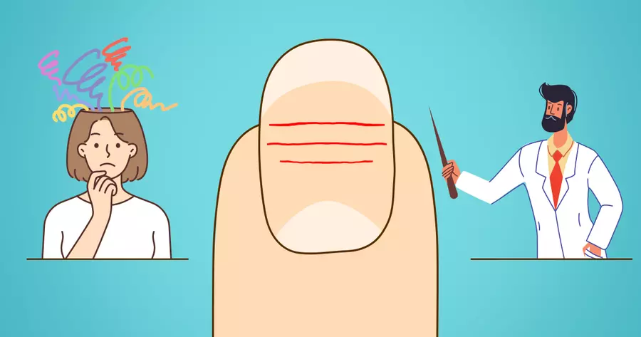 horizontal lines mean