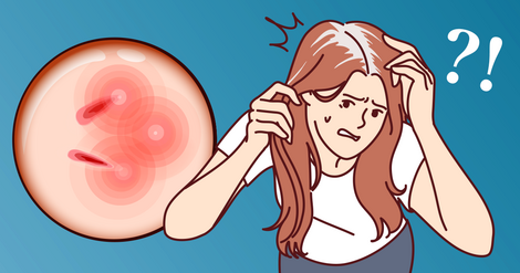 5 Over-the-Counter Treatments for Hidradenitis Suppurativa To Try ...