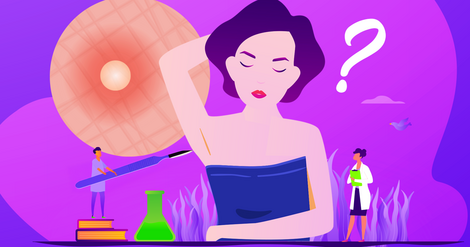 Using Prid for Boils as Part of Your HS Home Care Routine | myHSteam