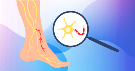 6 ATTR-CM Signs and Symptoms To Watch For | MyAmyloidosisTeam
