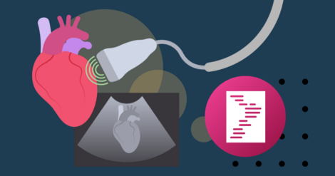 PYP Scan for Amyloidosis: What To Expect | MyAmyloidosisTeam