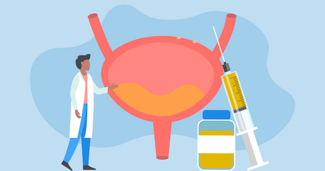 Chemo for Bladder Cancer: 7 Things To Expect | MyBladderCancerTeam