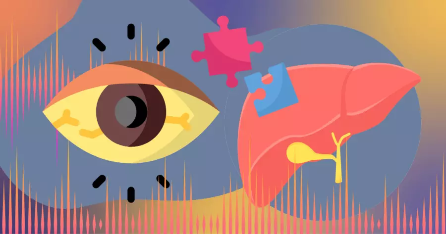 Jaundice and the Liver: What’s the Connection to PBC? | myPBCteam