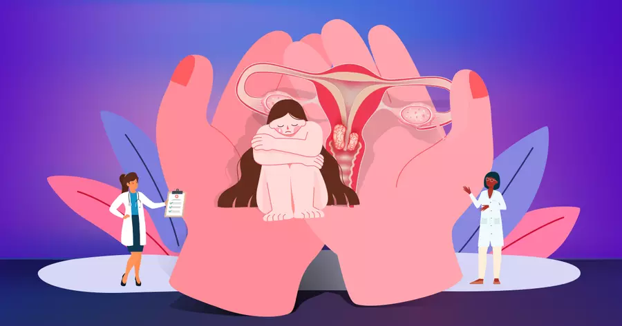 Endometrial Cancer Prognosis by Stage: Life Expectancy and Outlook ...