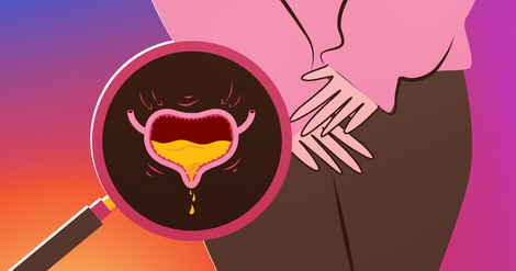 Stage 3 Bladder Cancer: Survival Rate, Symptoms, and More ...