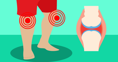 BMI for Class 3 Obesity: Ranges and Health Risks | MyObesityTeam