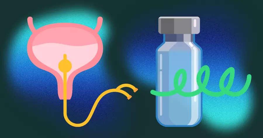 BCG Therapy for Non-Muscle-Invasive Bladder Cancer: What To Expect ...