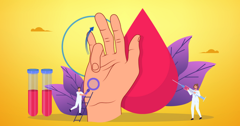 Why Diabetes Can Cause Dark Spots on Your Legs | DiabetesTeam