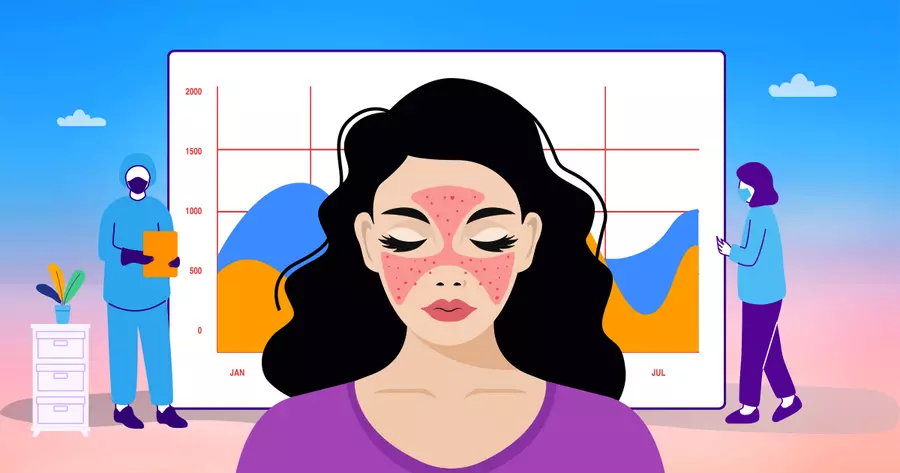 Lupus Statistics You Need To Know: Just How Common Is It? | MyLupusTeam