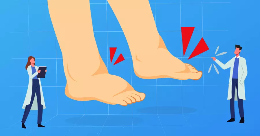 Lupus Toes and Feet: Swelling, Circulation Problems, and More | MyLupusTeam