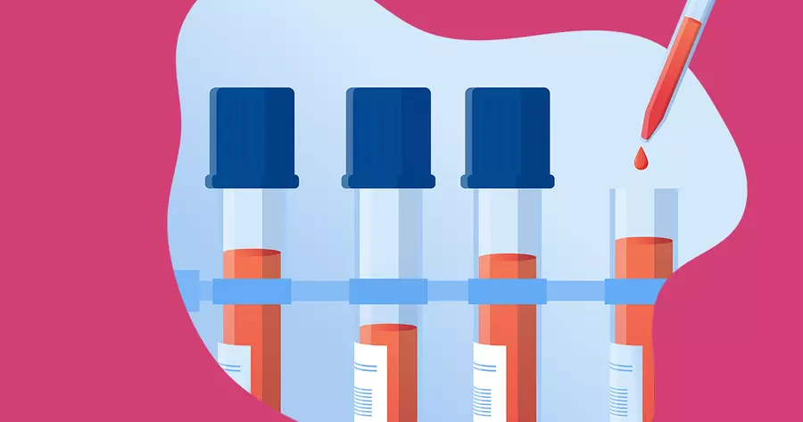 Blood Work for Lupus: Important Tests and What They Reveal | MyLupusTeam