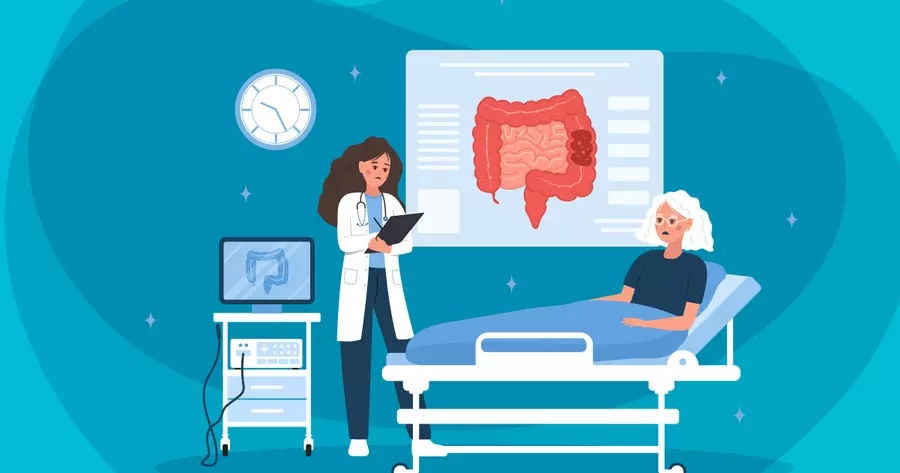 Is Ulcerative Colitis Deadly? Life Expectancy and Serious Complications ...