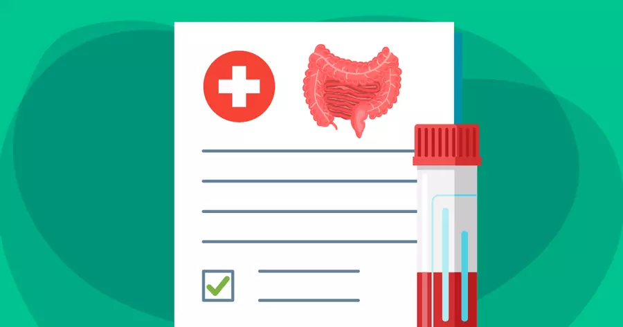 Blood Test for Ulcerative Colitis: Role in Diagnosis and Monitoring ...