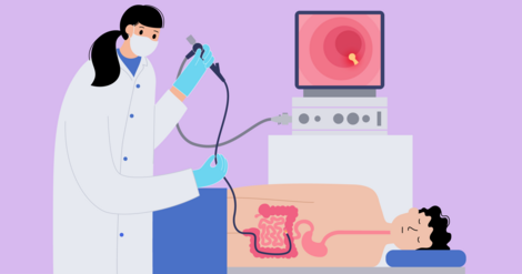 Getting a Colonoscopy for Crohn’s and Colitis: What To Expect ...