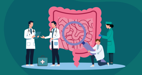 Proctitis vs. Ulcerative Colitis: 5 Facts To Know | MyCrohnsAndColitisTeam