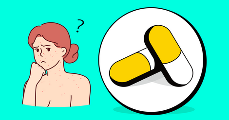 Unroofing for Hidradenitis Suppurativa (HS) | myHSteam