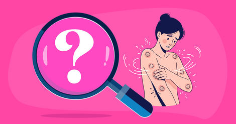 Do Abscesses Pop on Their Own: Will an Abscess Drain Naturally? | myHSteam