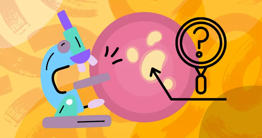 How Do Abscesses Form: What Is Inside an Abscess? | myHSteam