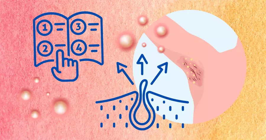 Home Remedies for Boils: How To Help a Boil Drain Safely | myHSteam