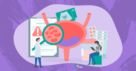 BCG Therapy for Non-Muscle-Invasive Bladder Cancer: What To Expect ...