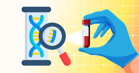 Can Statins Cause Alzheimer’s? What We Know | myALZteam
