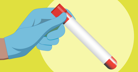CAH Diagnosis: 7 Tests and What To Expect | CAHteam