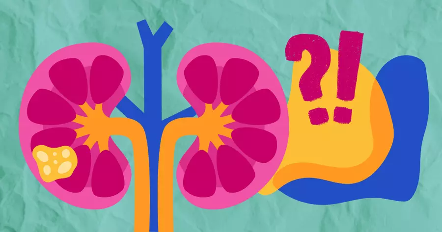 Renal Parenchymal Disease: Is It Dangerous? | MyKidneyDiseaseTeam