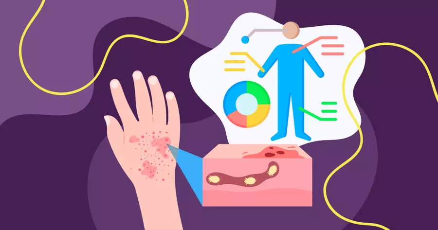 Shingles Symptoms: What To Watch Out For | MyHeartDiseaseTeam