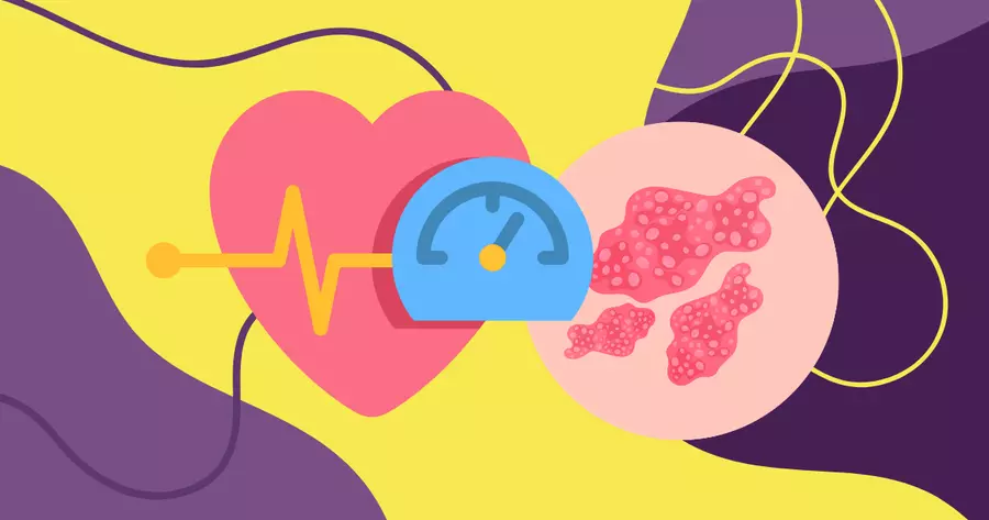 Can Shingles Affect Your Heart Rate? Understanding the Connection ...