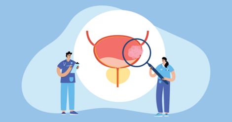 Non-Muscle-Invasive Bladder Cancer vs. Muscle-Invasive: How They Differ ...