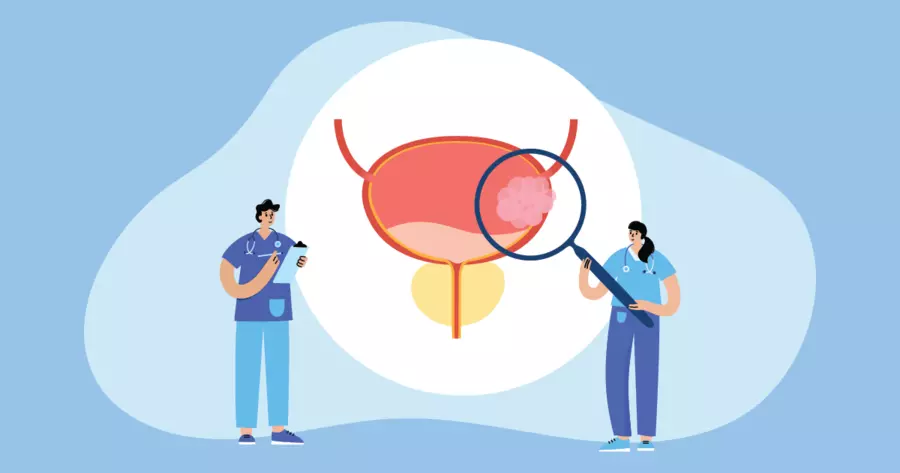 Muscle-Invasive Bladder Cancer: 7 Facts To Know | MyBladderCancerTeam
