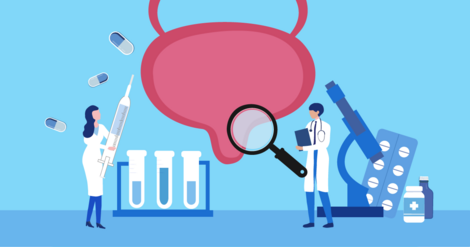 Cystoscopy for Bladder Cancer: What To Expect | MyBladderCancerTeam