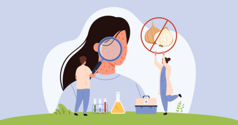 What Does a Food Allergy Rash Look Like? Pictures and Treatments ...