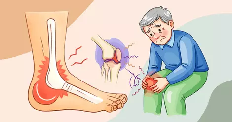 What Are the 6 Different Types of Diabetes? | DiabetesTeam