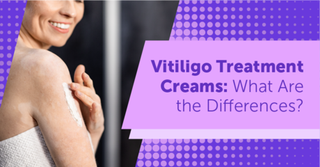 How To Track Your Vitiligo Progression Over Time | MyVitiligoTeam